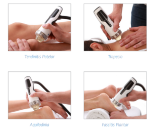 INTELECT FOCUS SHOCKWAVE: Onda de choque focales